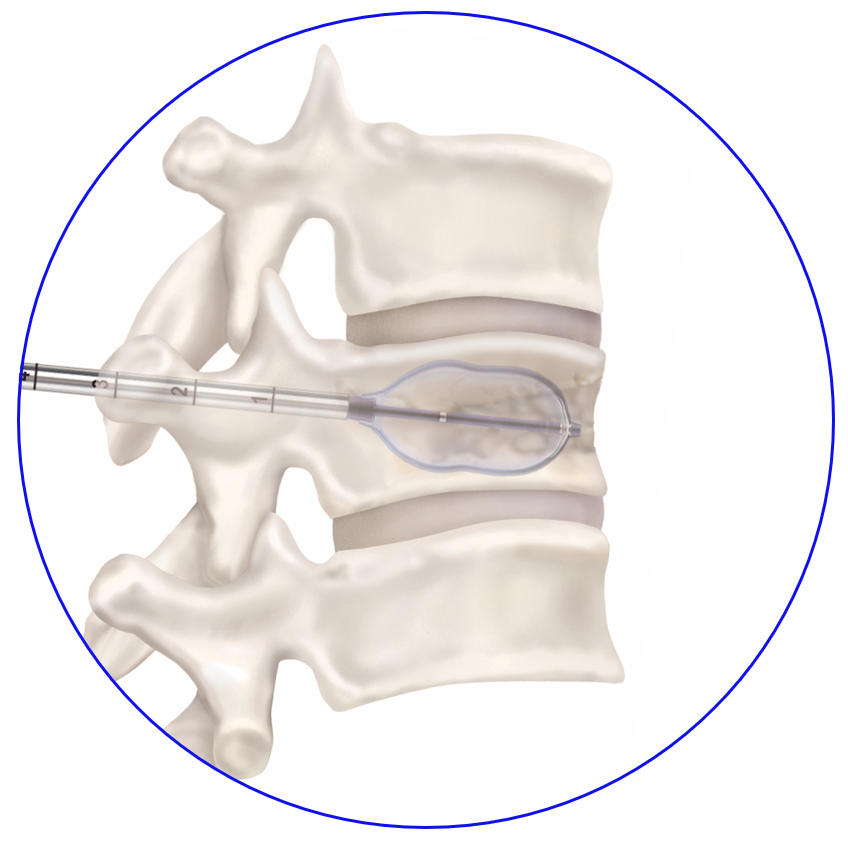 Addressing the opioid crisis
